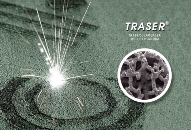 Permedica Orthopaedics - Implants Group LLC